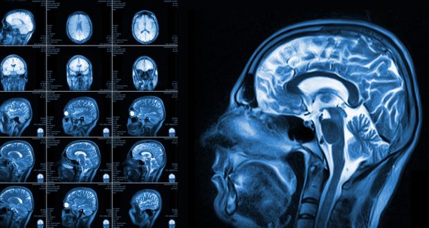 What Happens To Your Brain When You Give Up Sugar?